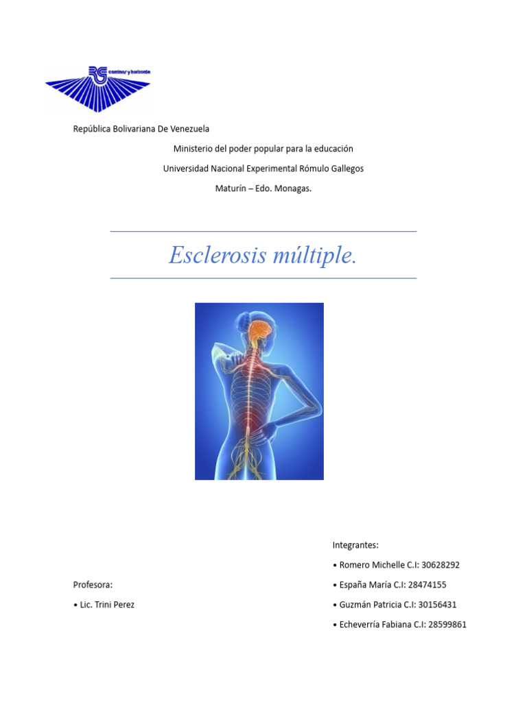 esclerosis múltiple | PDF | Esclerosis múltiple | Especialidades Medicas