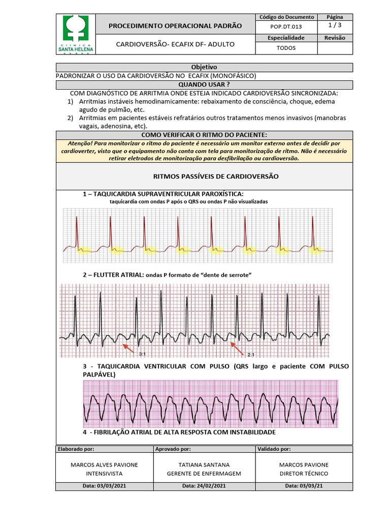 Cardioversão - Ecafix DF - Adulto | PDF | Eletrocardiografia | Arritmia ...