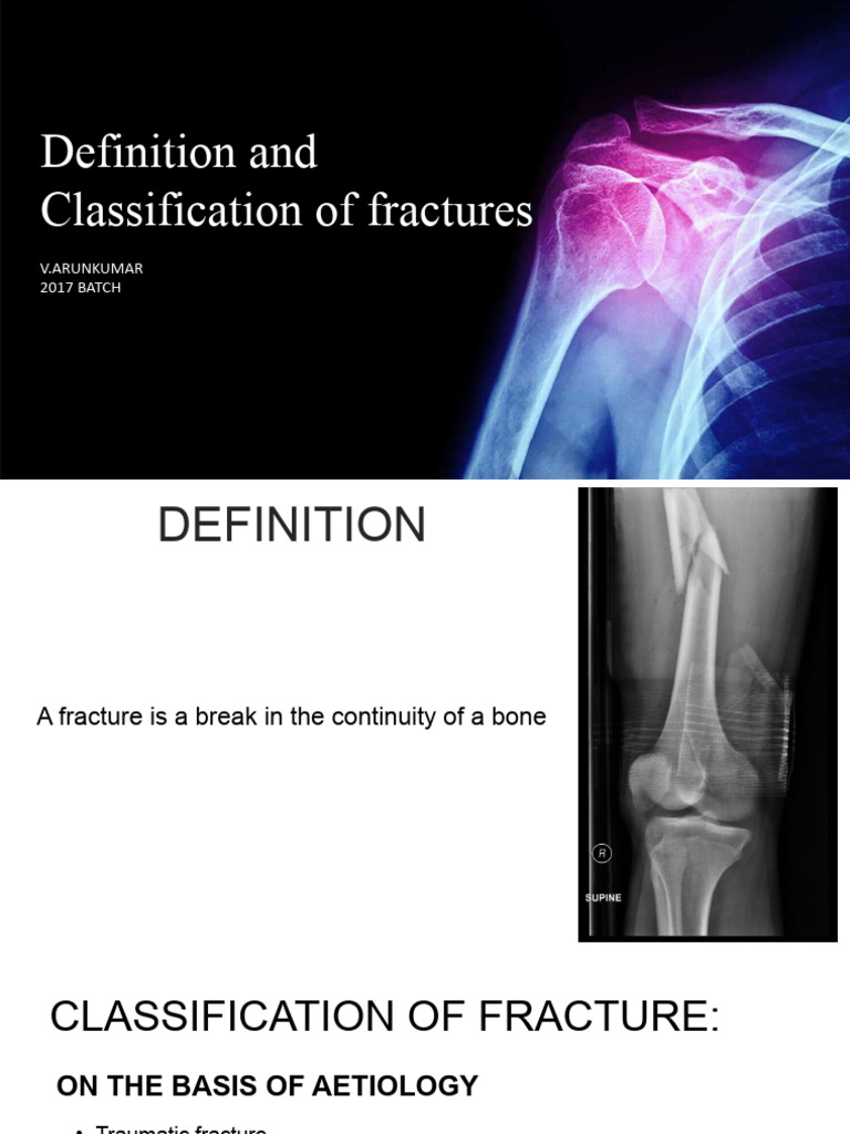 Fracture Types and Classifications | PDF | Bone | Diseases And Disorders