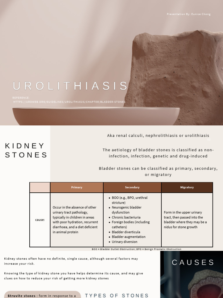 Urolithiasis Presentation | PDF | Medical Specialties | Clinical Medicine