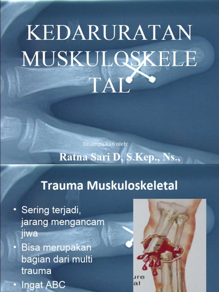 Penanganan Trauma Muskuloskeletal | PDF
