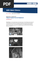 Drehmann Sign and Femoro Acetabular Impingement In.7 | PDF | Hip ...