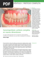 Protocolo Impresión Definitiva para Protesis Total | PDF | Dentadura ...