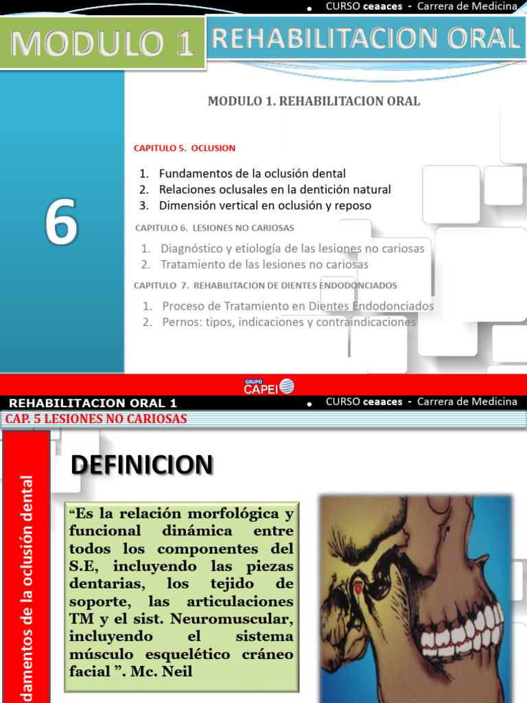 Rehabilitacion Oral - Oclusion - Lesion Cariosa - Tratamiento de ... Rehabilitacion Oral - Oclusion - Lesion Cariosa - Tratamiento de ...