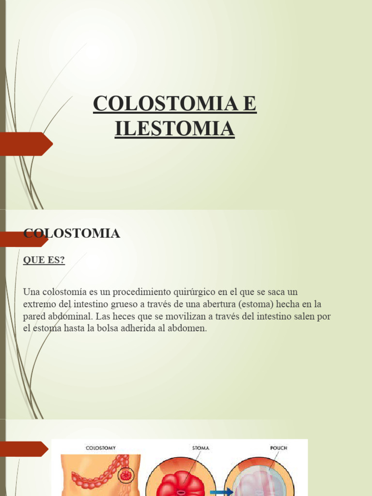 Guía de Colostomía e Ileostomía | PDF | Ciencias sociales | Ciencia y ...