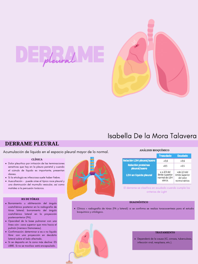 Derrame Pleural | PDF