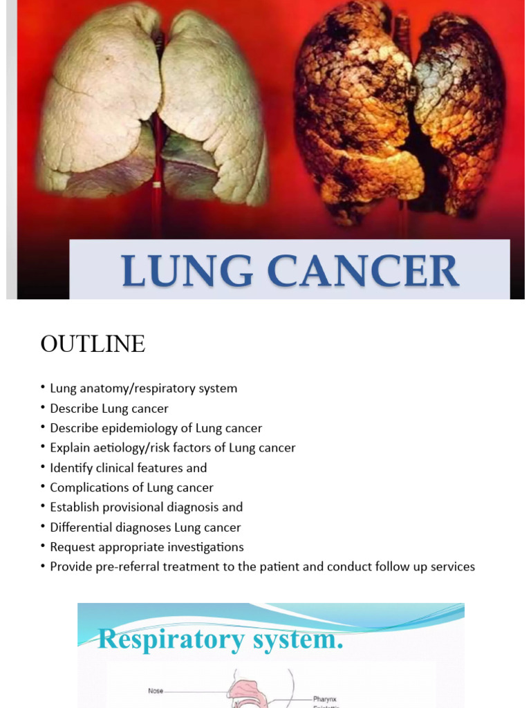 Lung Cancer | PDF | Lung Cancer | Cancer