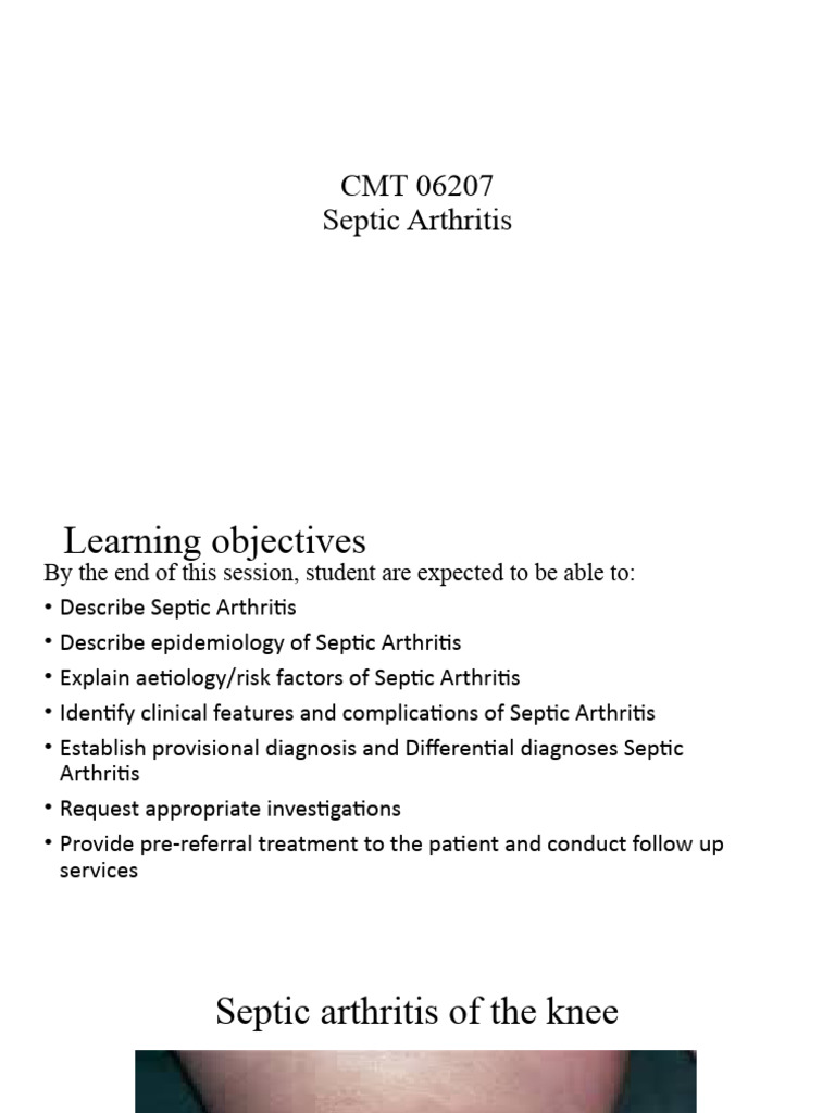 Session 9 - Septic Arthritis | PDF | Arthritis | Sepsis