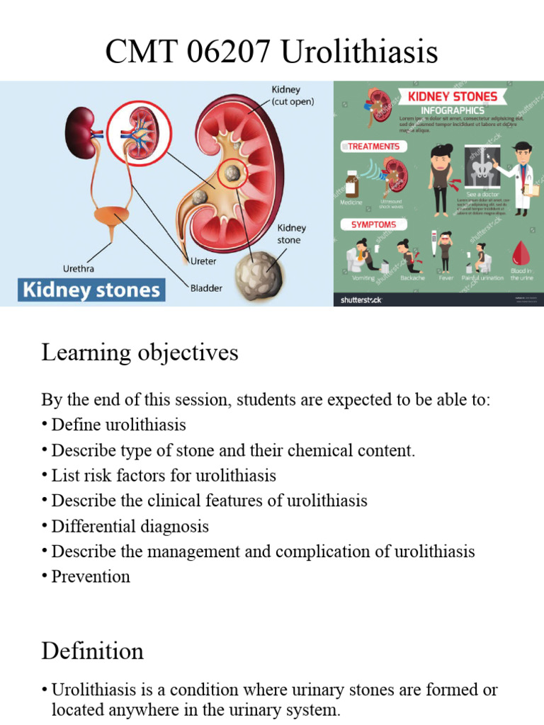 Understanding Urolithiasis: Key Insights | PDF | Causes Of Death ...