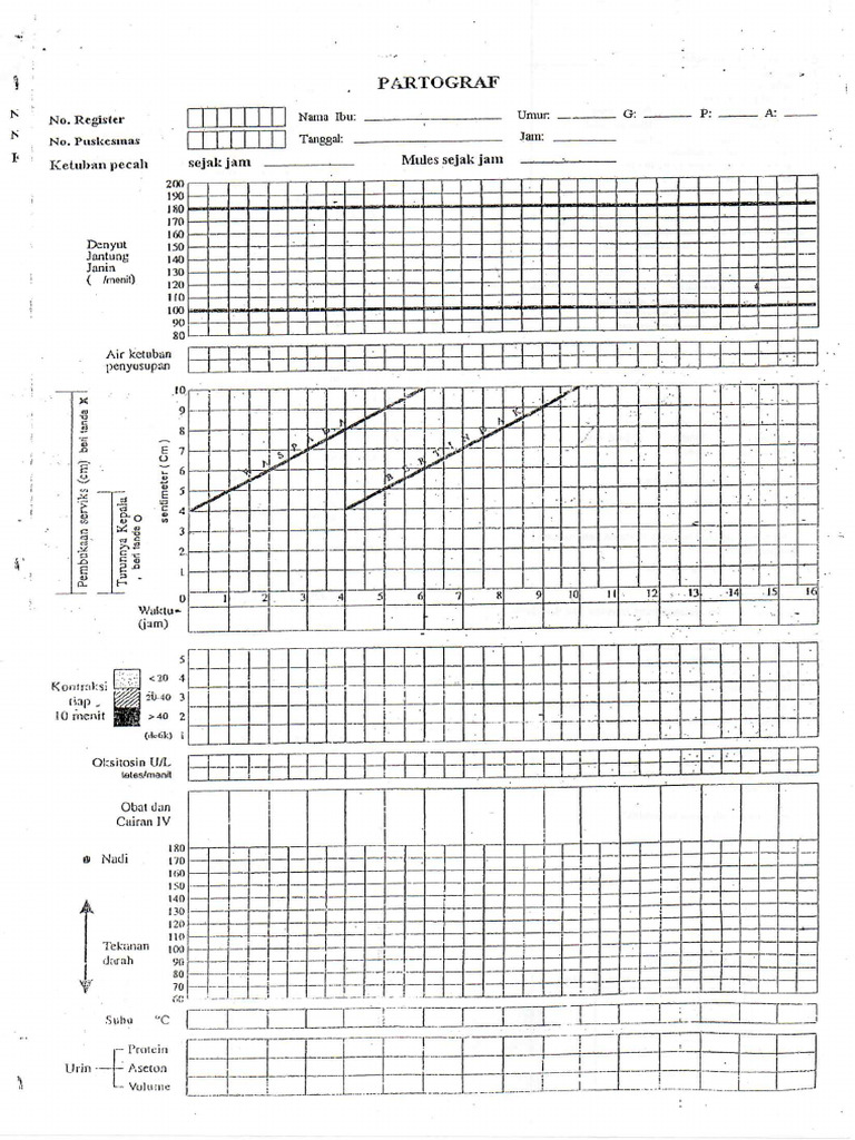 Partograf | PDF