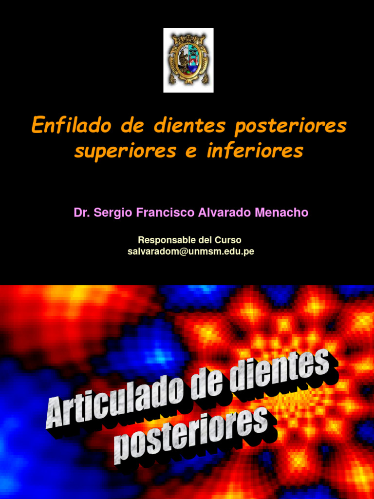 012 Enfilado de Dientes Posteriores Superiores e Inferiores | PDF ...