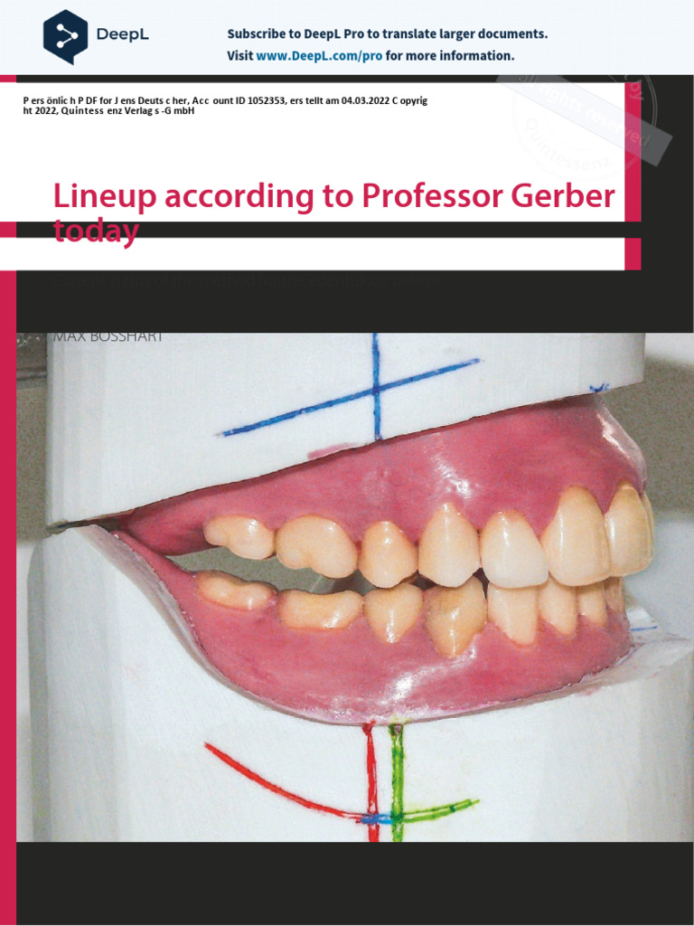 MAX Denture en-US | PDF | Dental Implant | Dentures