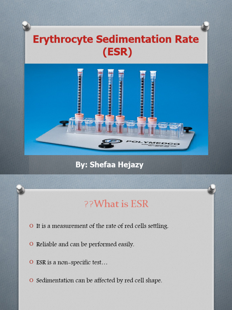 Erythrocyte Sedimentation Rate - SH Fina | PDF | Causes Of Death ...