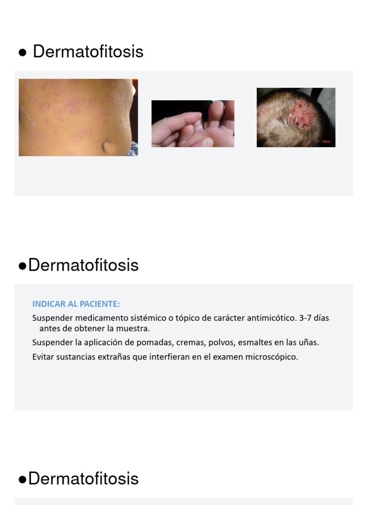 Dermatofitosis | PDF | Microbiología | Causas de la muerte