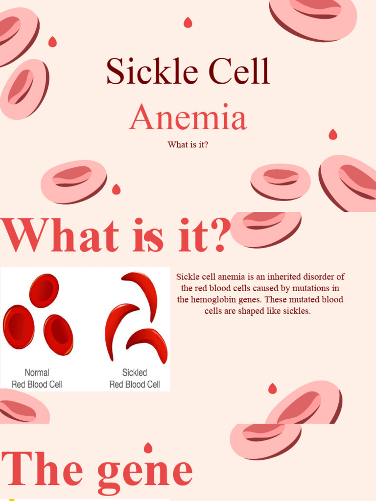 Sickle Cell Anemia Project Gene10 | PDF | Hematology | Blood