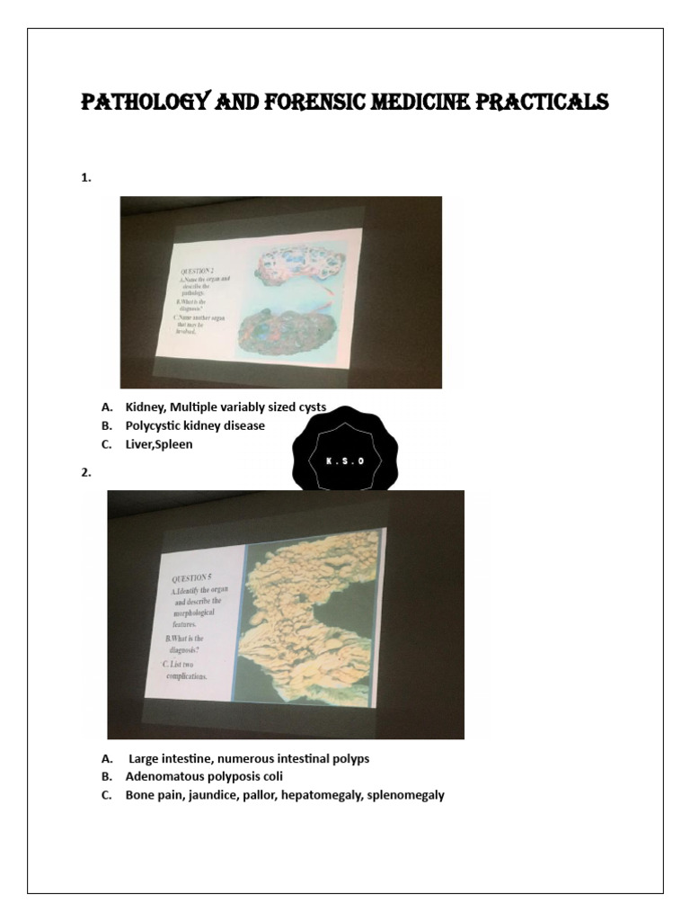 Pathology and Forensic Medicine Cases | PDF | Heart Failure | Liver