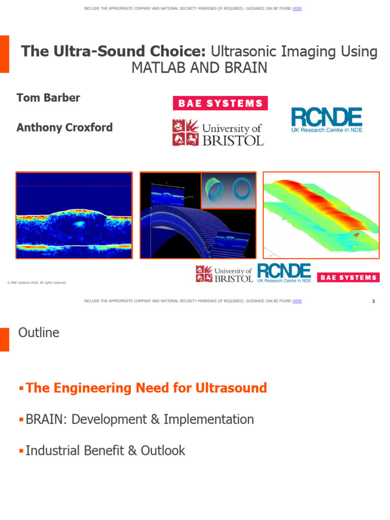 The Ultra Sound Choice Ultrasonic Imaging Using Matlab and Brain | PDF ...