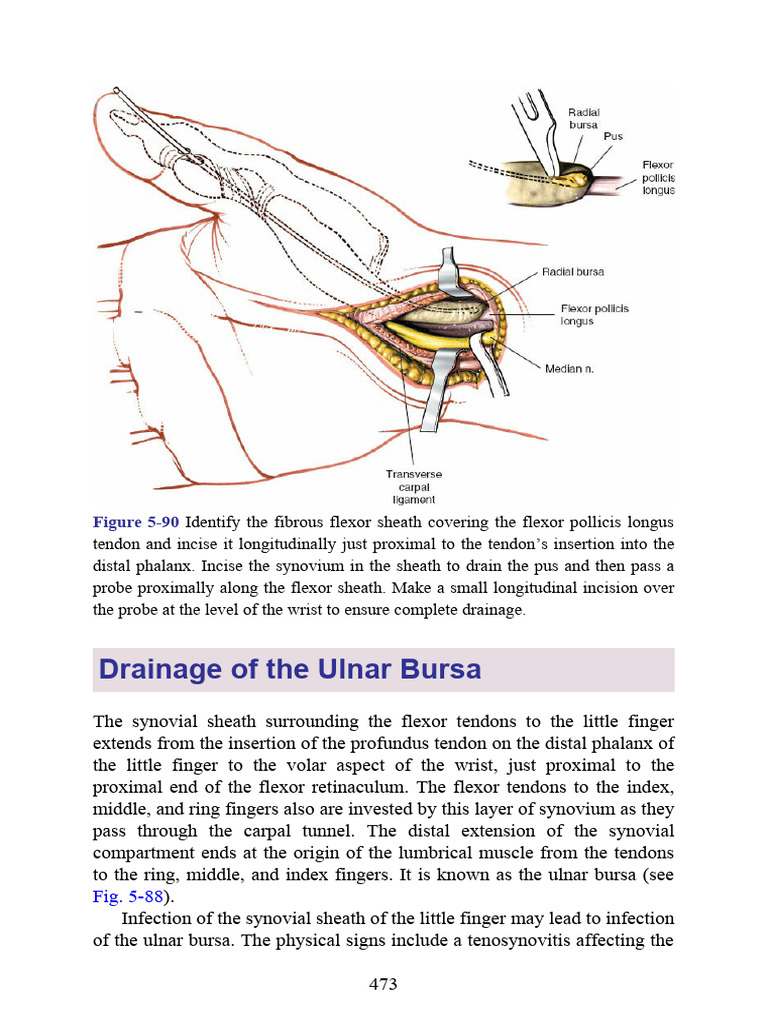 2017-Surgical Exposures in Ortho | PDF | Hand | Finger