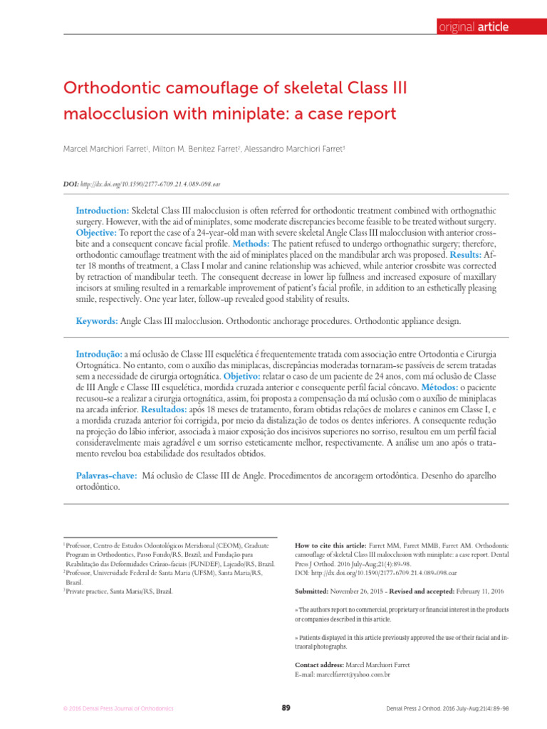 Orthodontic Camouflage of Skeletal Class III Malocclusion With ...