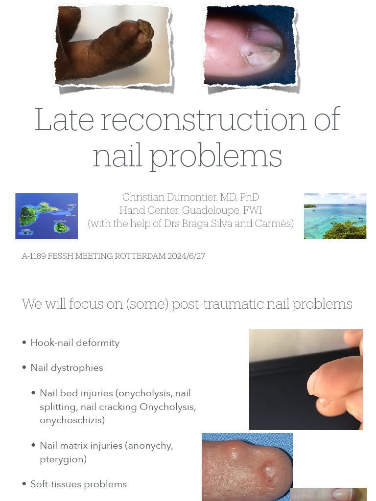 Post-Traumatic Nail Reconstruction | PDF | Nail (Anatomy) | Toe