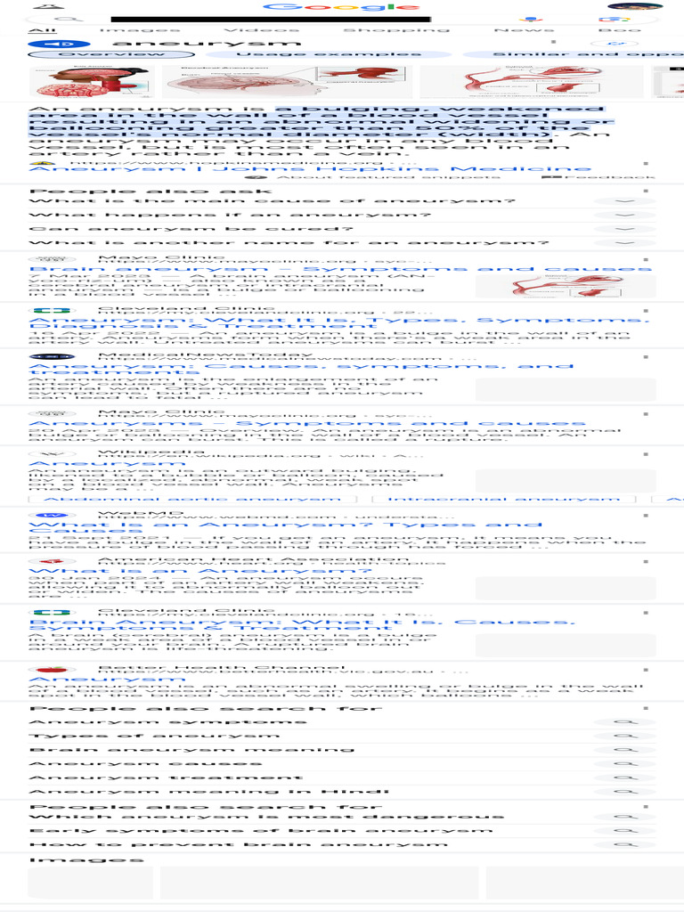 Aneurysm Meaning - Google Search | PDF | Clinical Medicine | Angiology