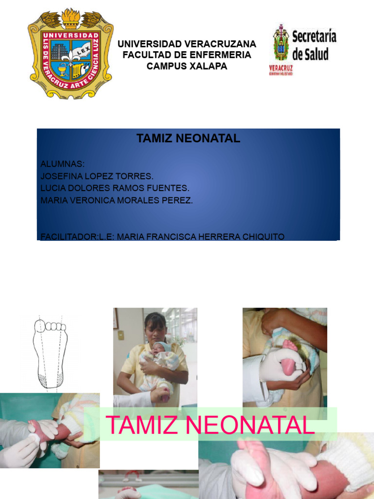 Importancia del Tamiz Neonatal | PDF | Infantes | Tiroides