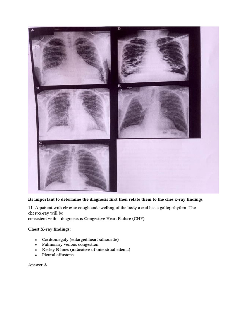 Matching Chest X Ray | PDF Matching Chest X Ray | PDF