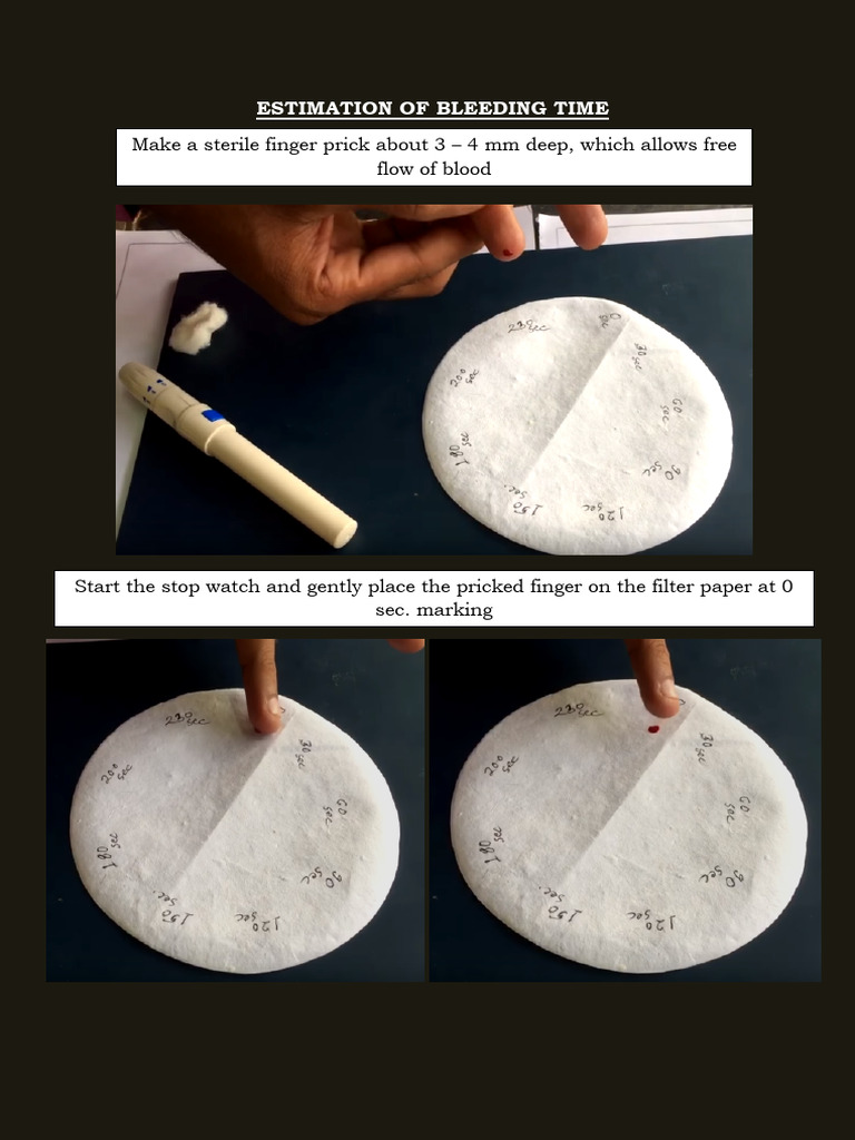 Estimating Bleeding Time Procedure | PDF | Social Science
