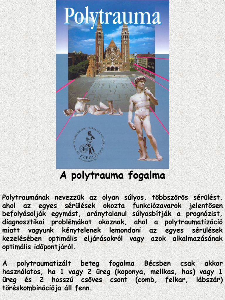 13 1-Polytrauma | PDF