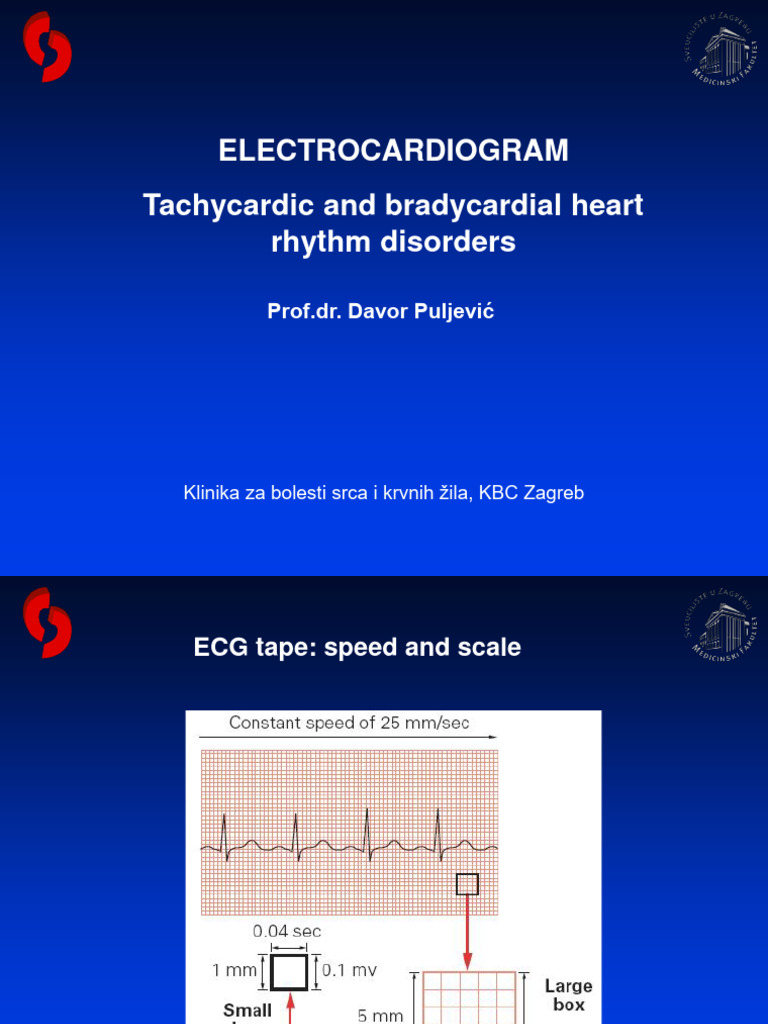 EKG-studentiTahiBradiDEF-Za englezeNOVO | PDF | Electrocardiography | Cardiac Arrhythmia