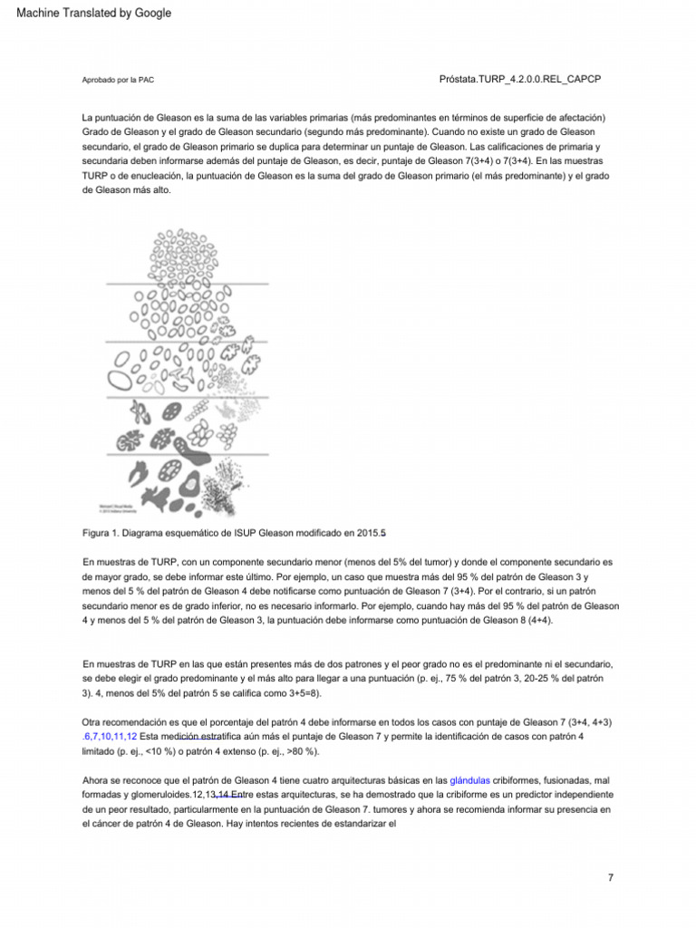 Evaluación Gleason en Muestras TURP | PDF | Cáncer | Cancer de prostata