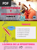 Protocolo de Episiotomía y Episiorrafia | PDF | Parto | Especialidades ...