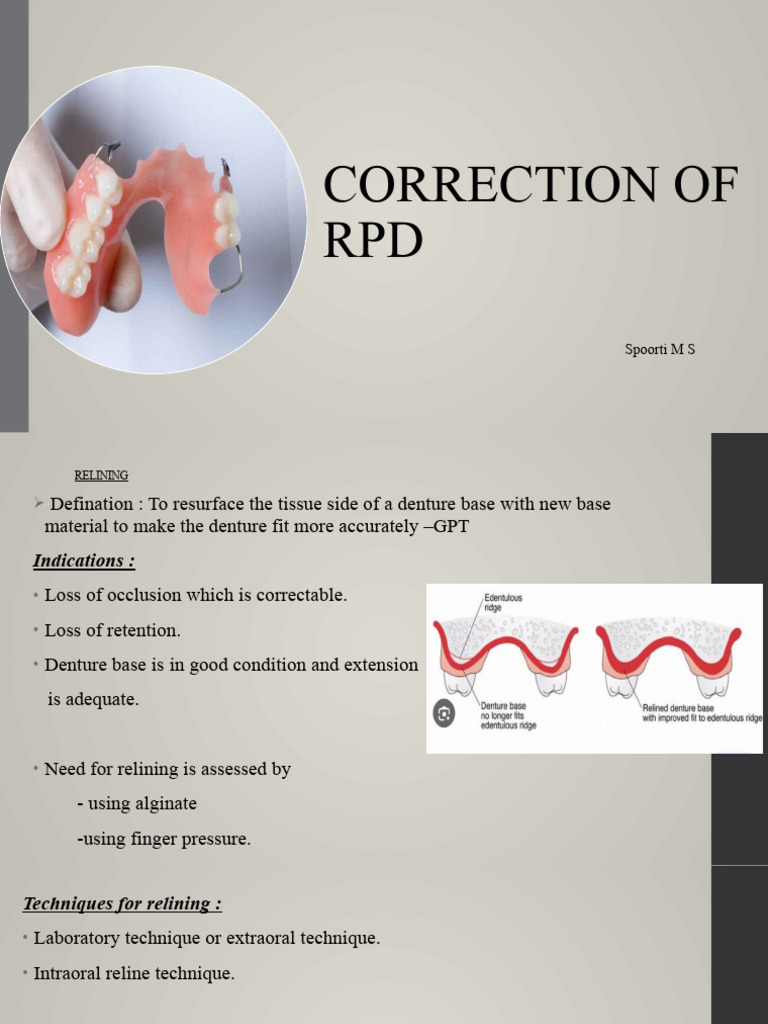 Correction of RPD | PDF | Dentures | Mouth