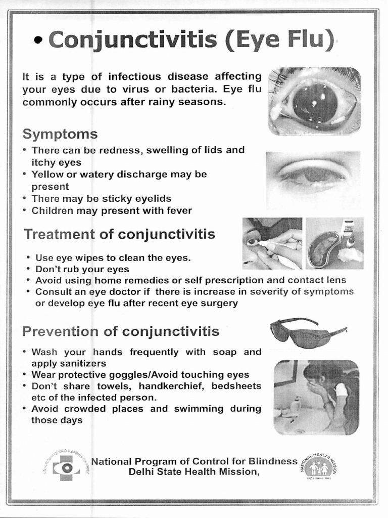 Conjunctivitis: Symptoms and Prevention | PDF | Home & Garden