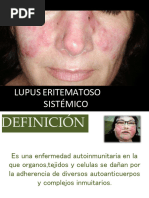 Diagnóstico y manejo del lupus eritematoso | PDF | Medicina CLINICA ...