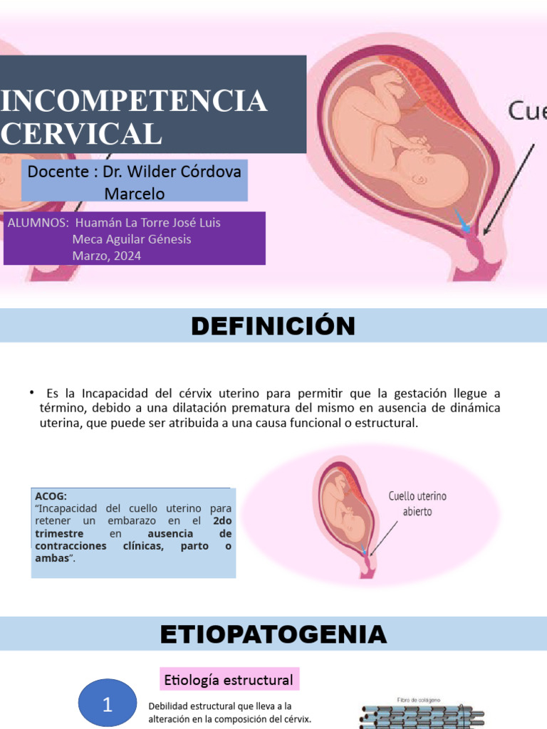 INCOMPETENCIA CERVICAL | Descargar gratis PDF | El embarazo | Parto