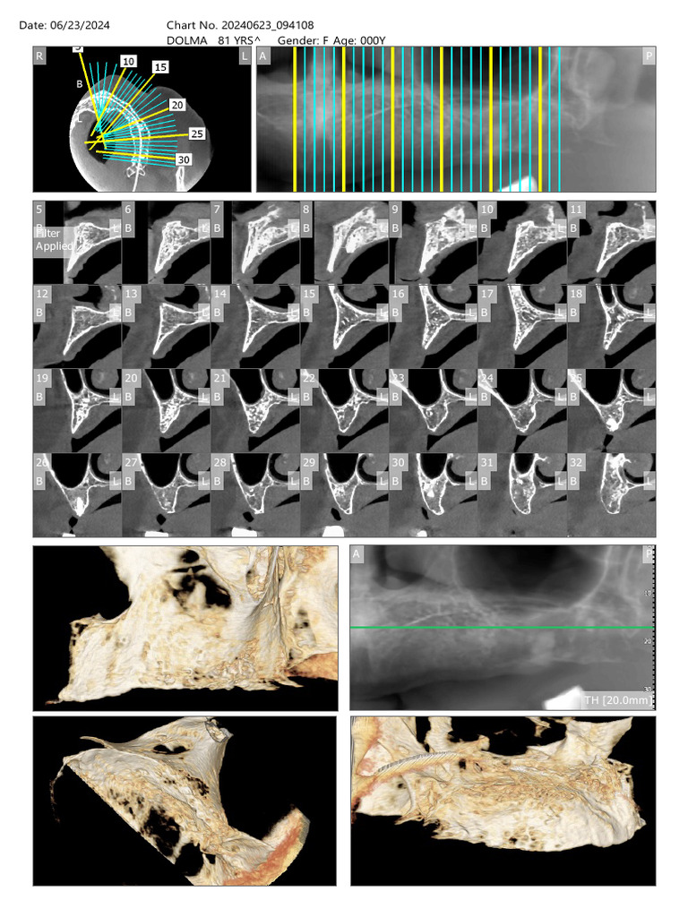 Patient Chart Overview for 81-Year-Old Female | PDF