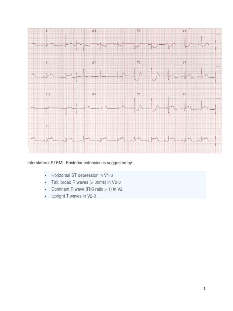 MI Examples | PDF