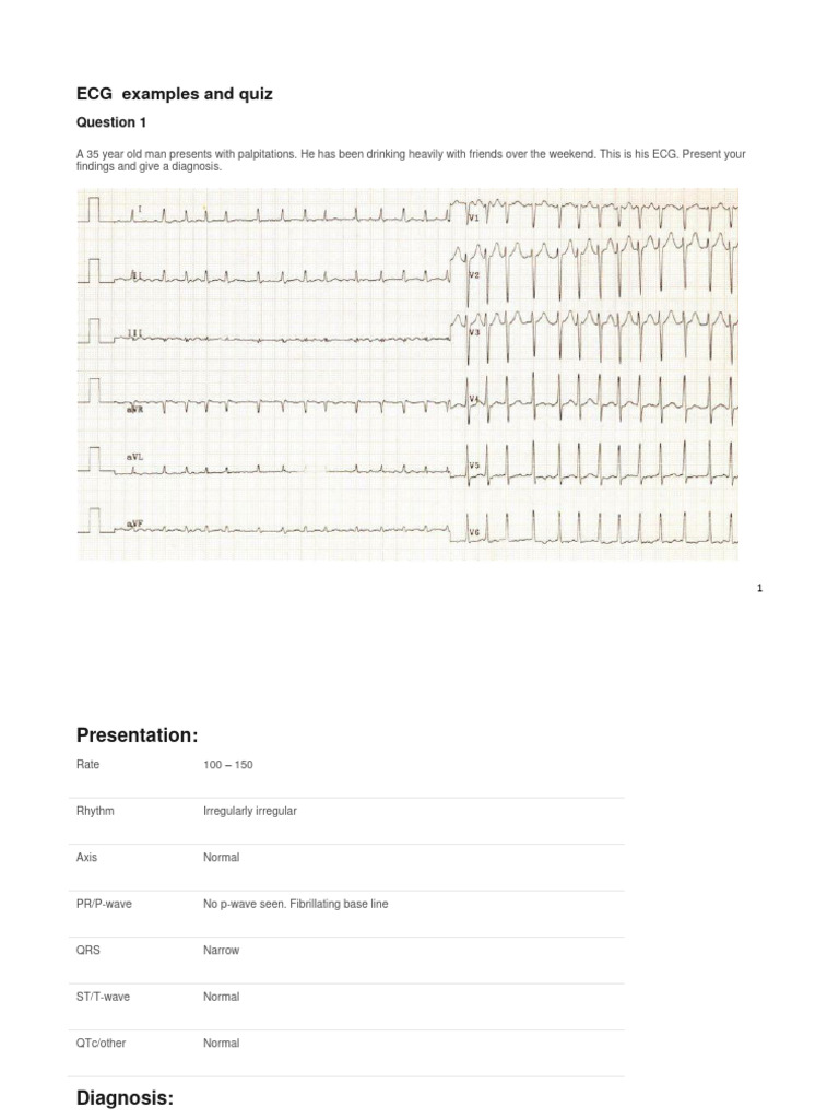 ECG Examples and Quiz (OME) | PDF | Electrocardiography | Myocardial ...