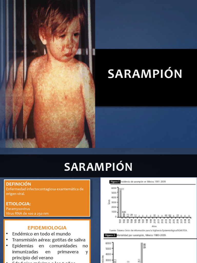 Sarampion C3baltima | PDF | Sarampión | Enfermedades animales