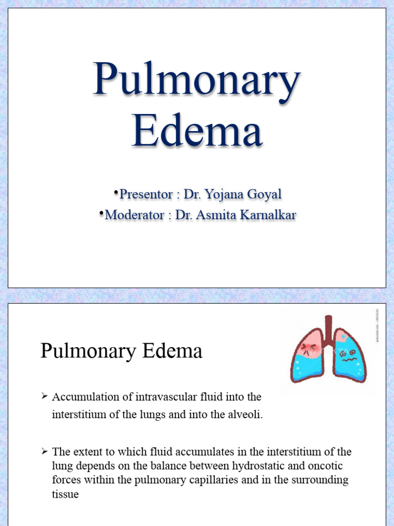Pulmonary Edema | Download Free PDF | Lung | Edema