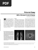 MRI With MR Fistulogram For Perianal Fistula - A Successful Combination ...