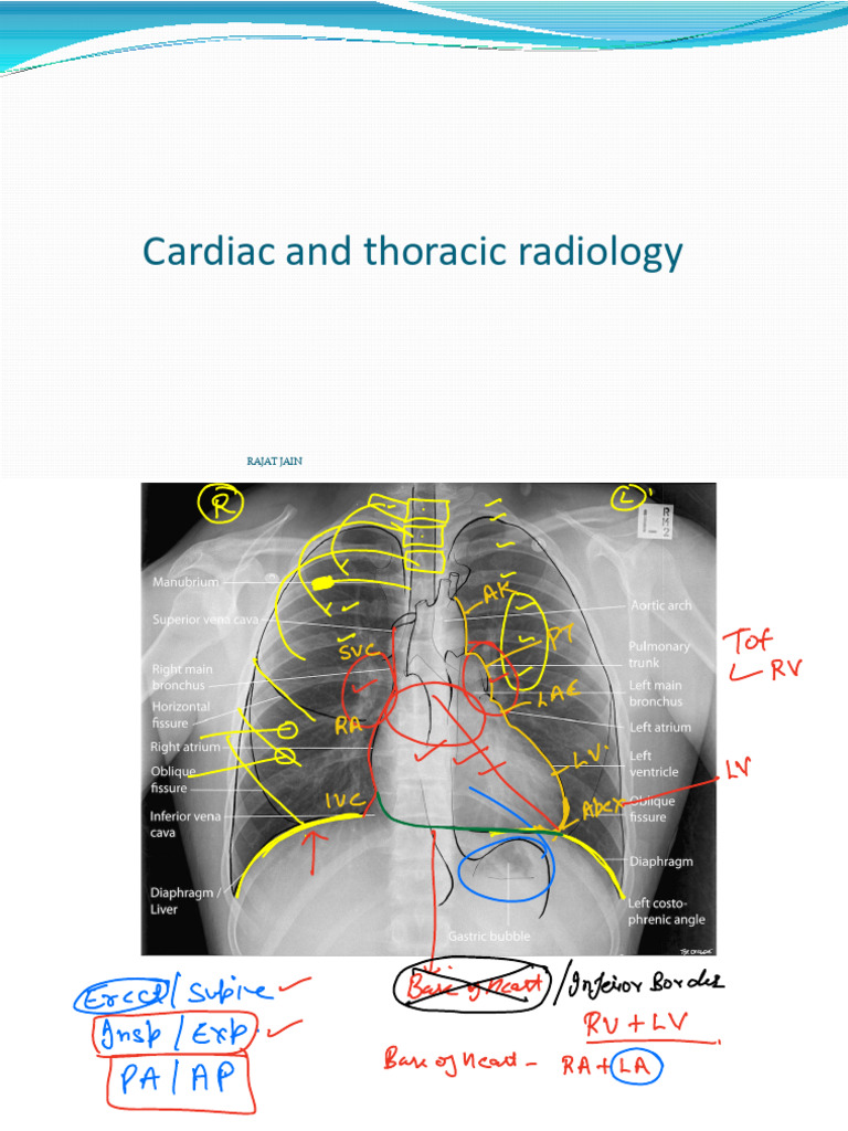 Radiology Day 3 Part 1 (9) | PDF | Angiology | Cardiovascular System