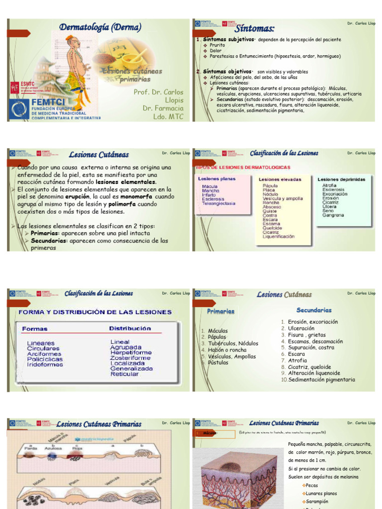 Guía de Lesiones Cutáneas Primarias | PDF | Melanoma | Cáncer