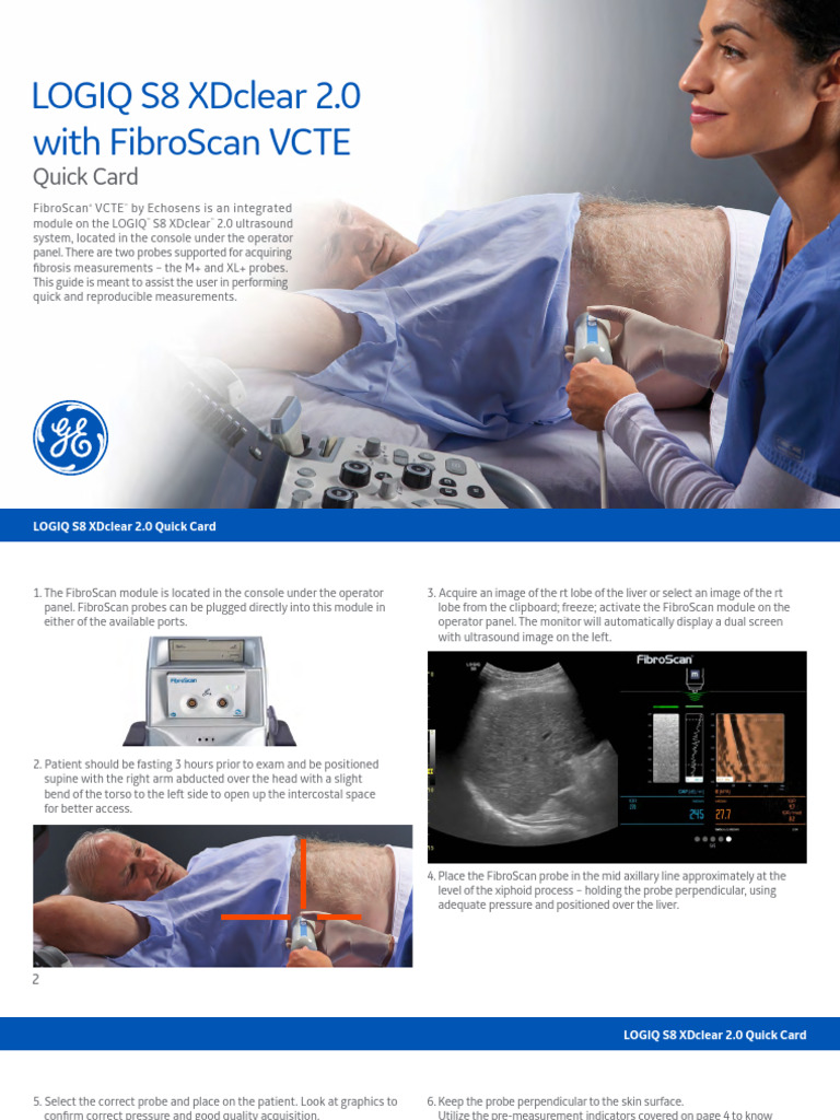 LOGIQ S8 XDclear 2.0 FibroScan Quick Card | PDF | Waves