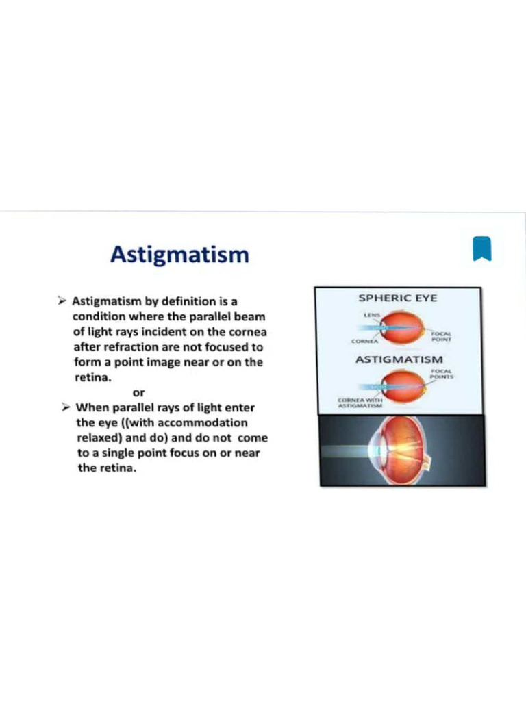 Astigmatism | PDF