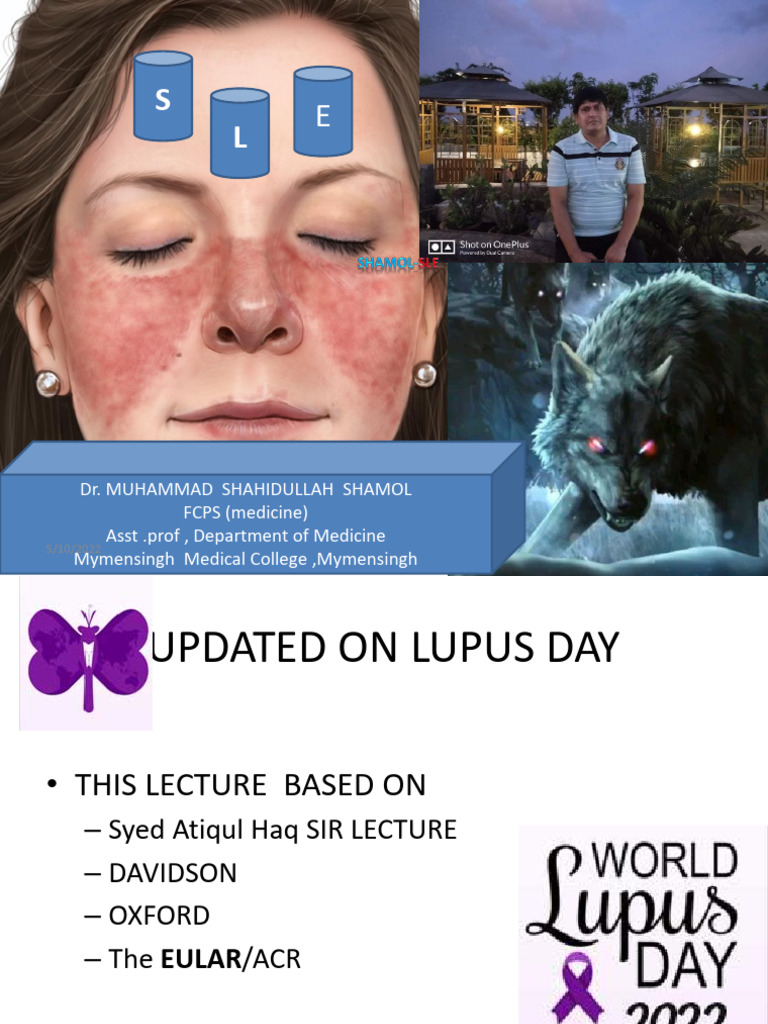 Lupus | PDF | Causes Of Death | Medical Specialties