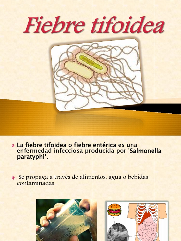 fiebre tifoidea | Especialidades Medicas | Enfermedades y trastornos