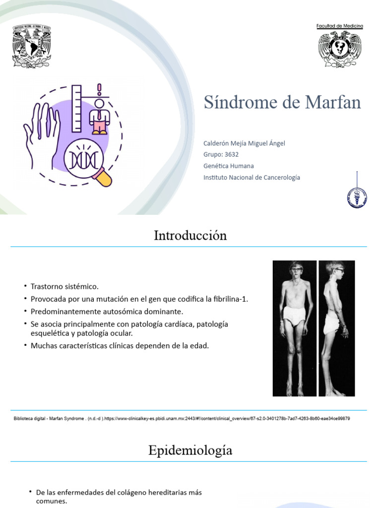Síndrome de Marfan | PDF | Medicina CLINICA | Especialidades Medicas