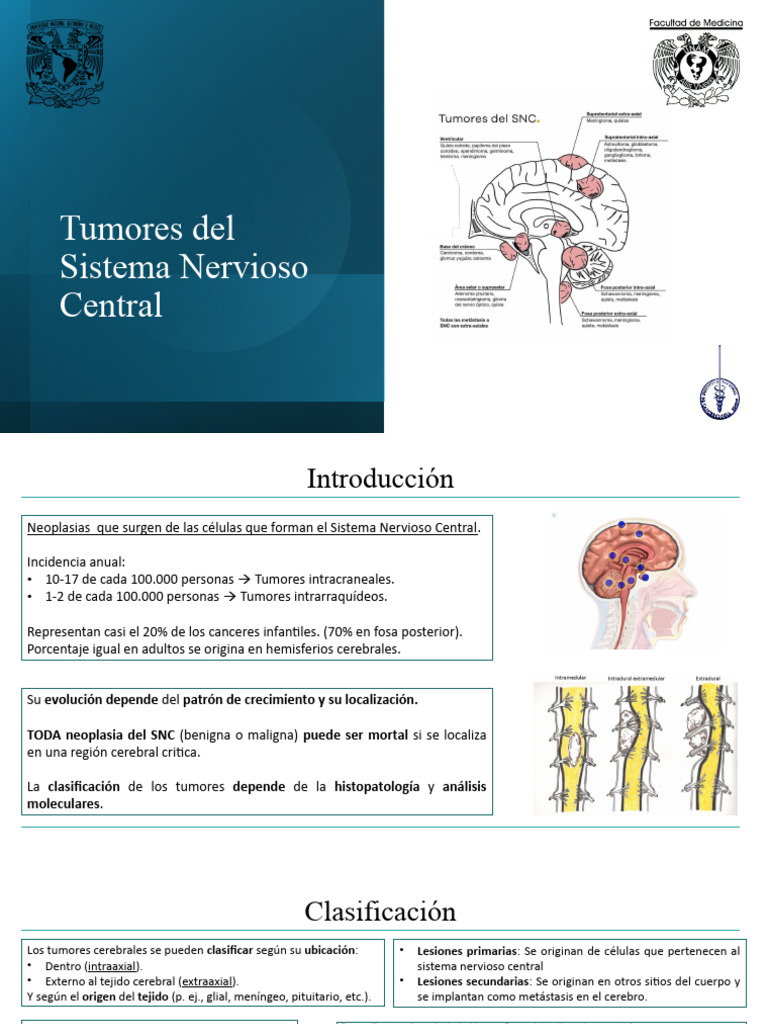 Tumores del Sistema Nervioso Central | PDF | Glioma | Tumor cerebral